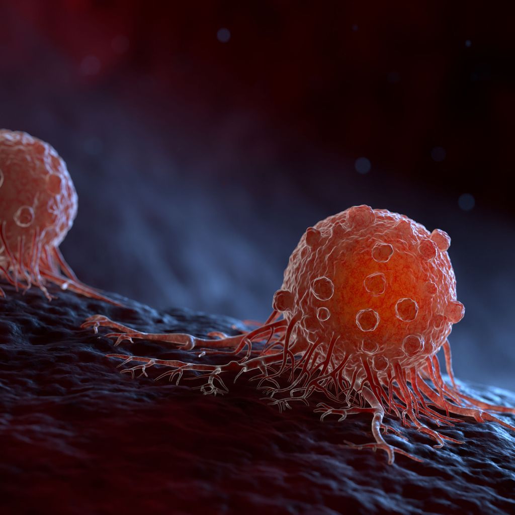 Das metaplastische Mammakarzinom - Onkologie - Universimed - Medizin im ...